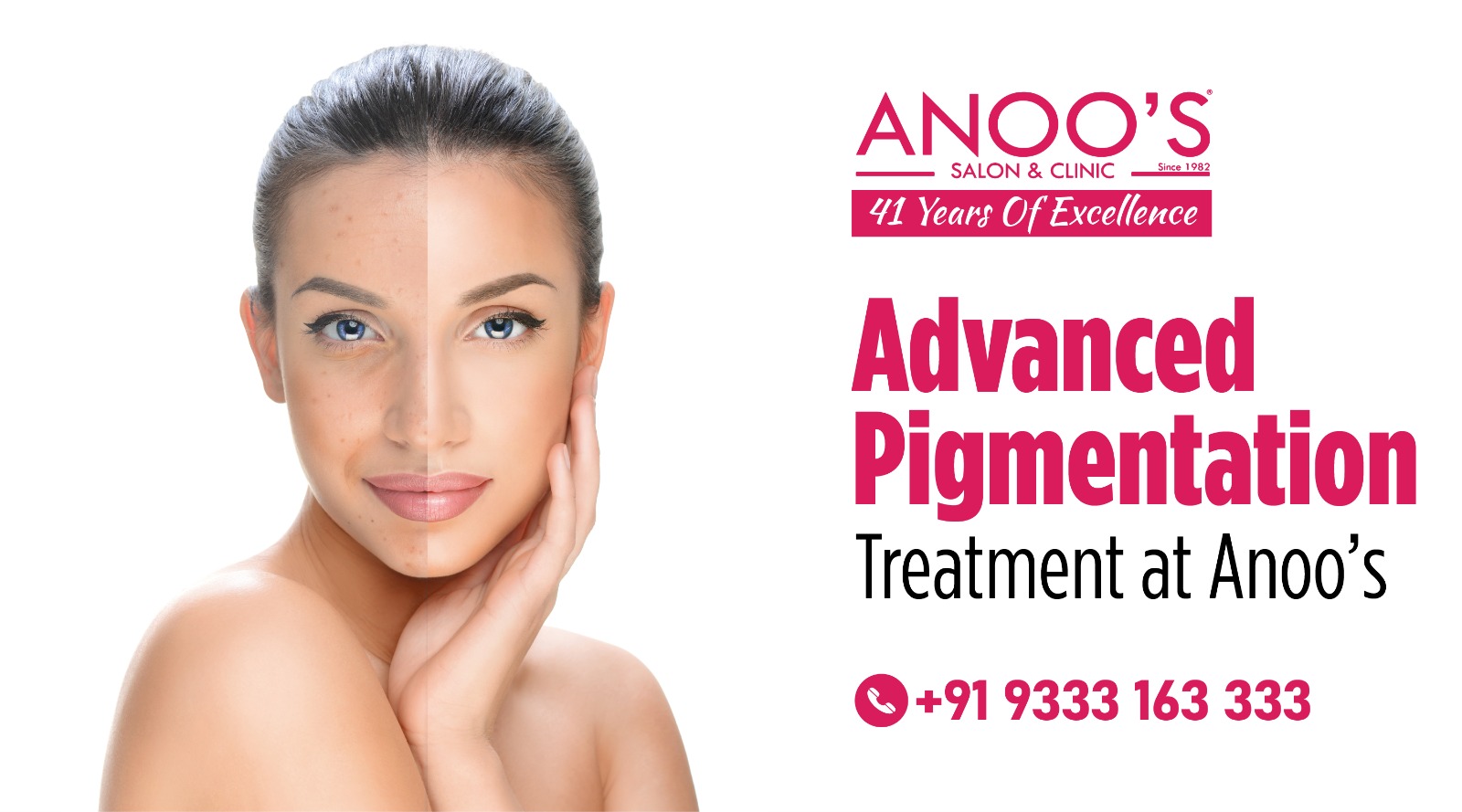 Pigmentation: How to Treat on Different Parts of Your Body