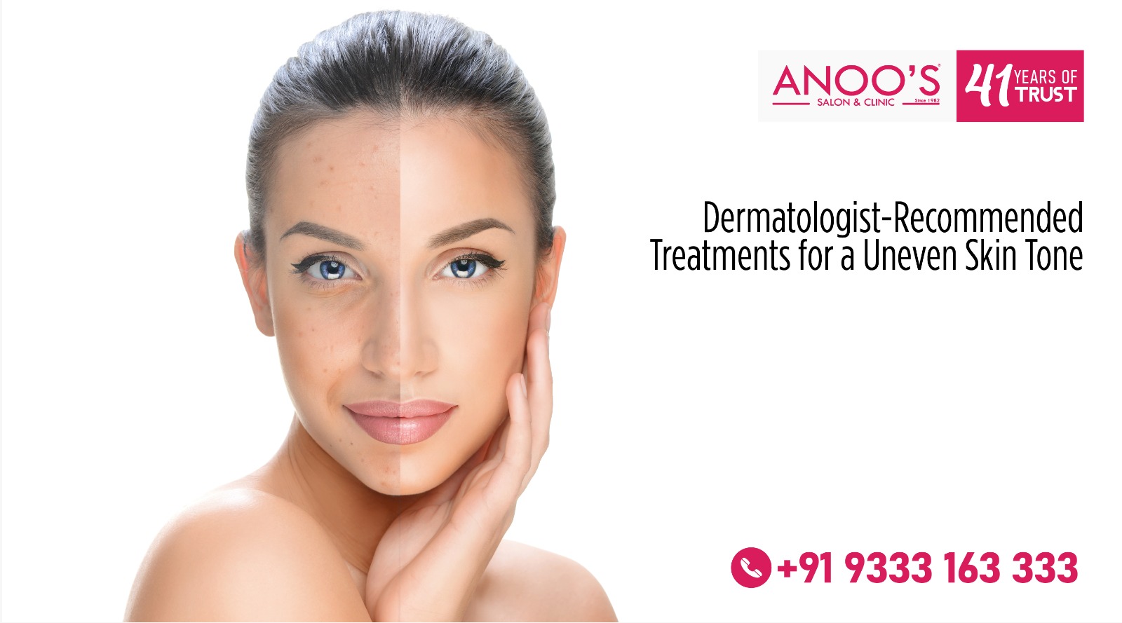 Uneven Skin Tone: Dermatologist Recommended Treatments